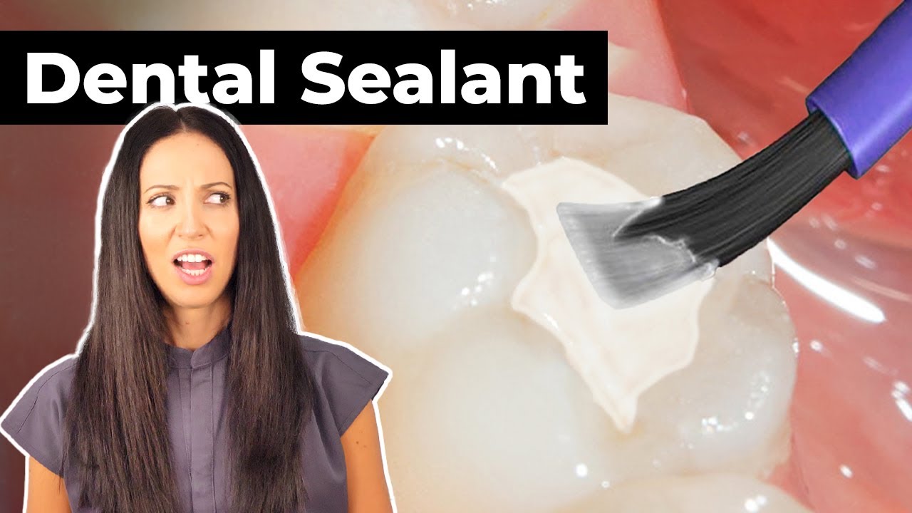 how LIQUID PLASTIC helps PROTECT your teeth - Etoners