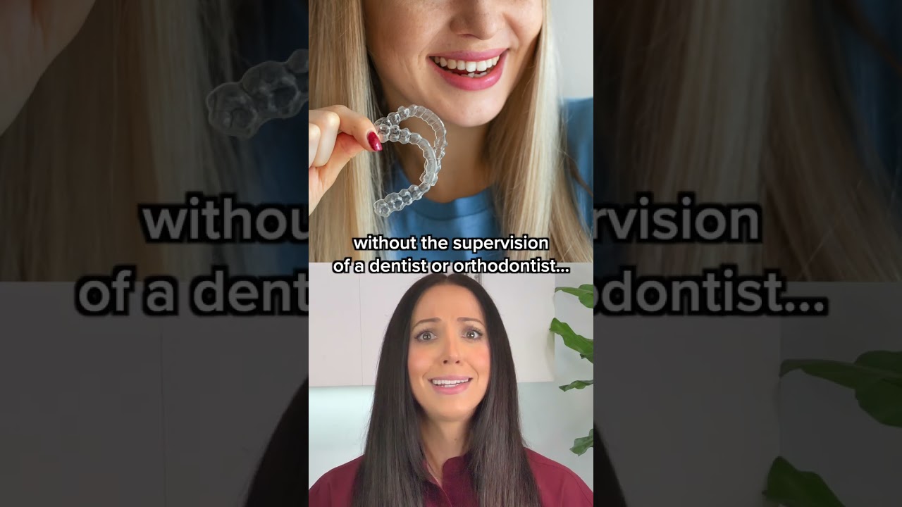 Invisalign Vs Smile Direct Club Teeth Straightening Shorts Etoners