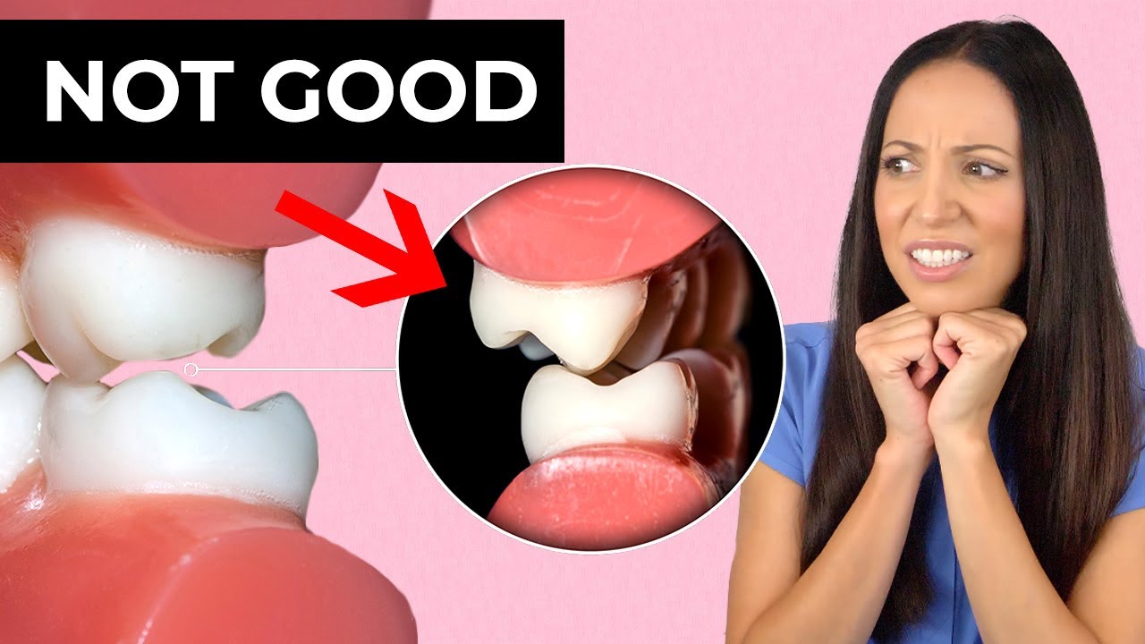 Is Your Bite A Problem Etoners