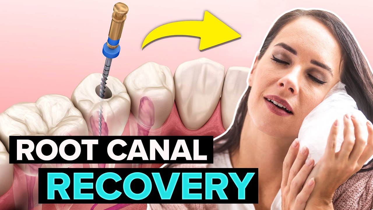 5 Root Canal Recovery Tips To Heal FAST! - Etoners