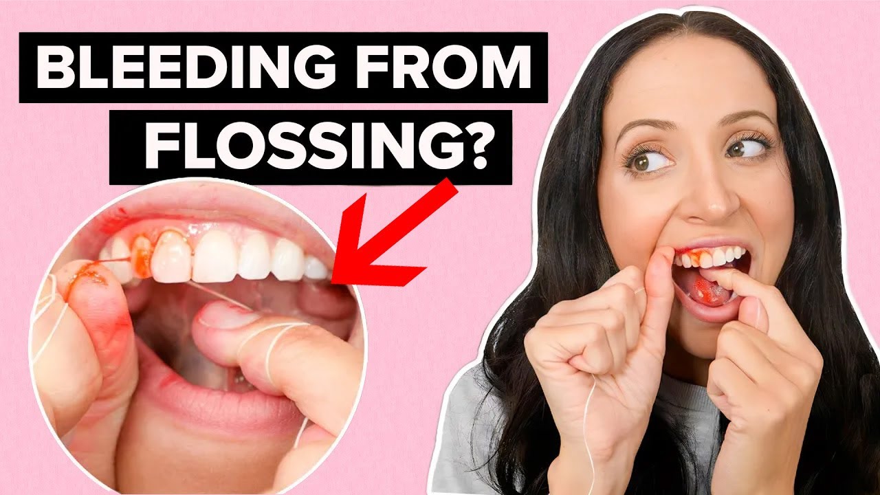 If Your Gums Bleed When You Floss... Watch This Video! - Etoners