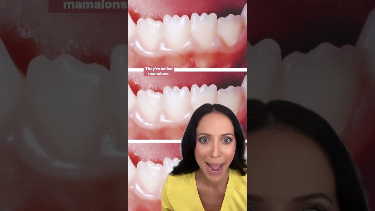what are teeth mamelons? #shorts - Etoners